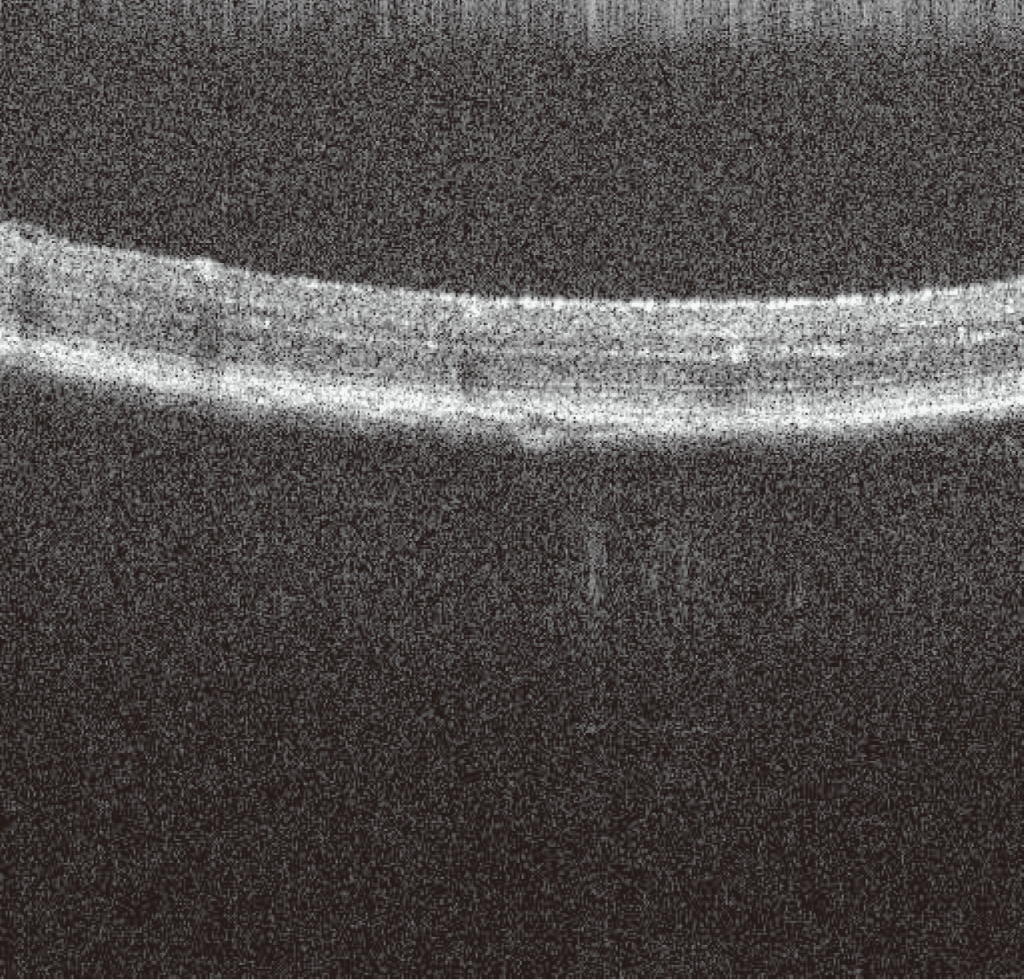 小动物专用 OCT成像系统 - 用于小鼠、狗、马等动物的眼科检测 | 仅供研究使用 | 多物种识别 | 友思特科技